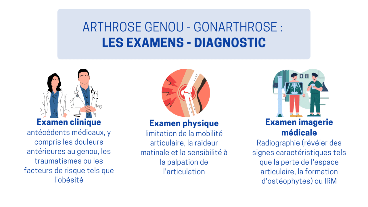 Tout savoir sur l'Arthrose Genou ou Gonarthrose