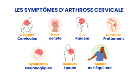 Arthrose cervicale : Symptômes, Causes, Traitements douleurs cou